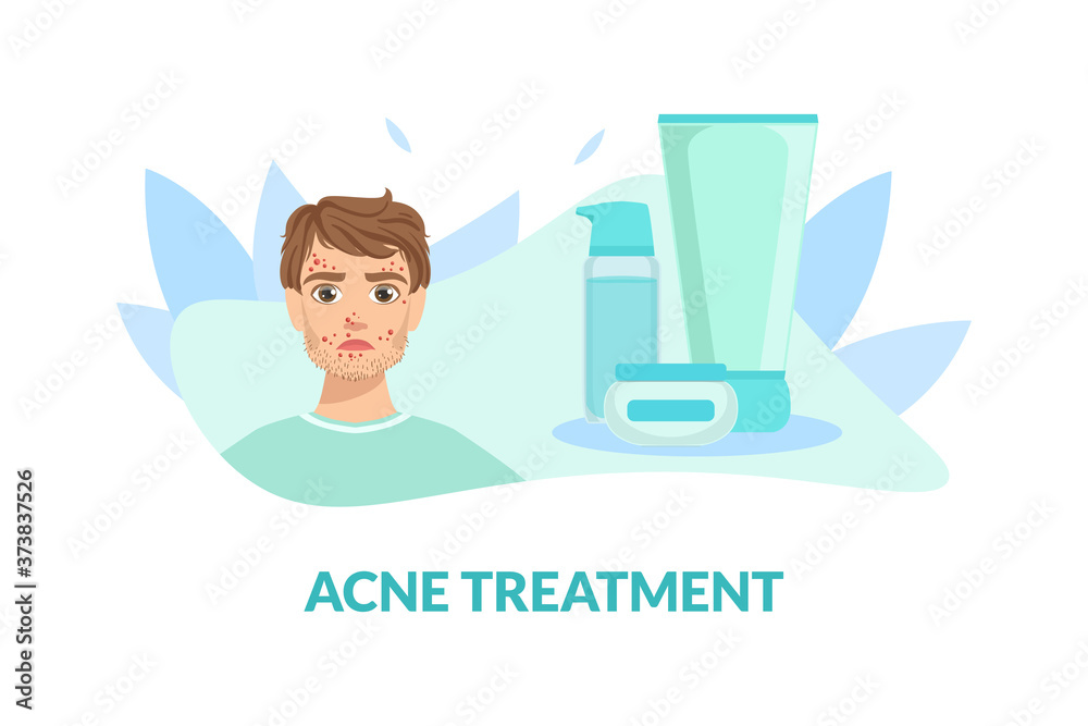Acne Treatment Banner Template, Guy with Skin Problems Vector ...