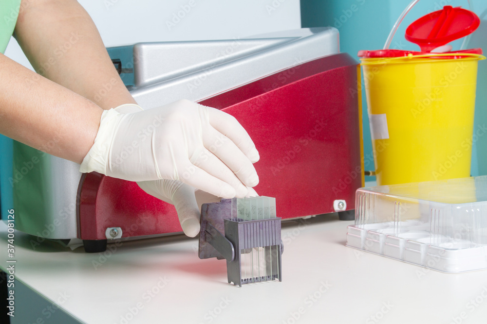 Foto de Histology test lab in hospital. Hands in gloves, tech loads ...