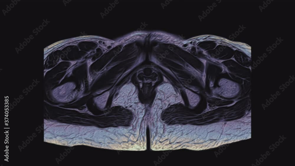 Bulk multicolored MRI of the female pelvic organs, abdominal cavity ...