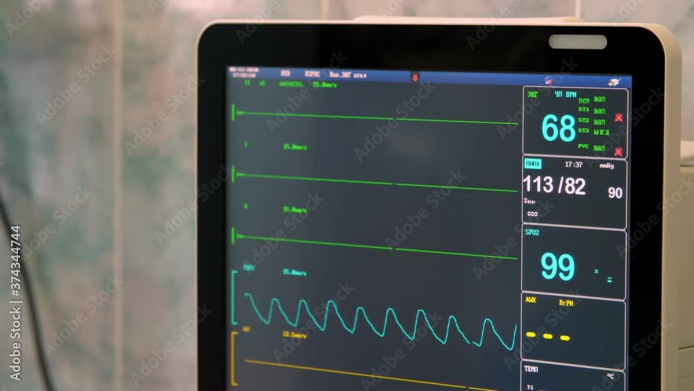 close-up. Anesthetic monitor shows patient blood pressure, rhythm and ...