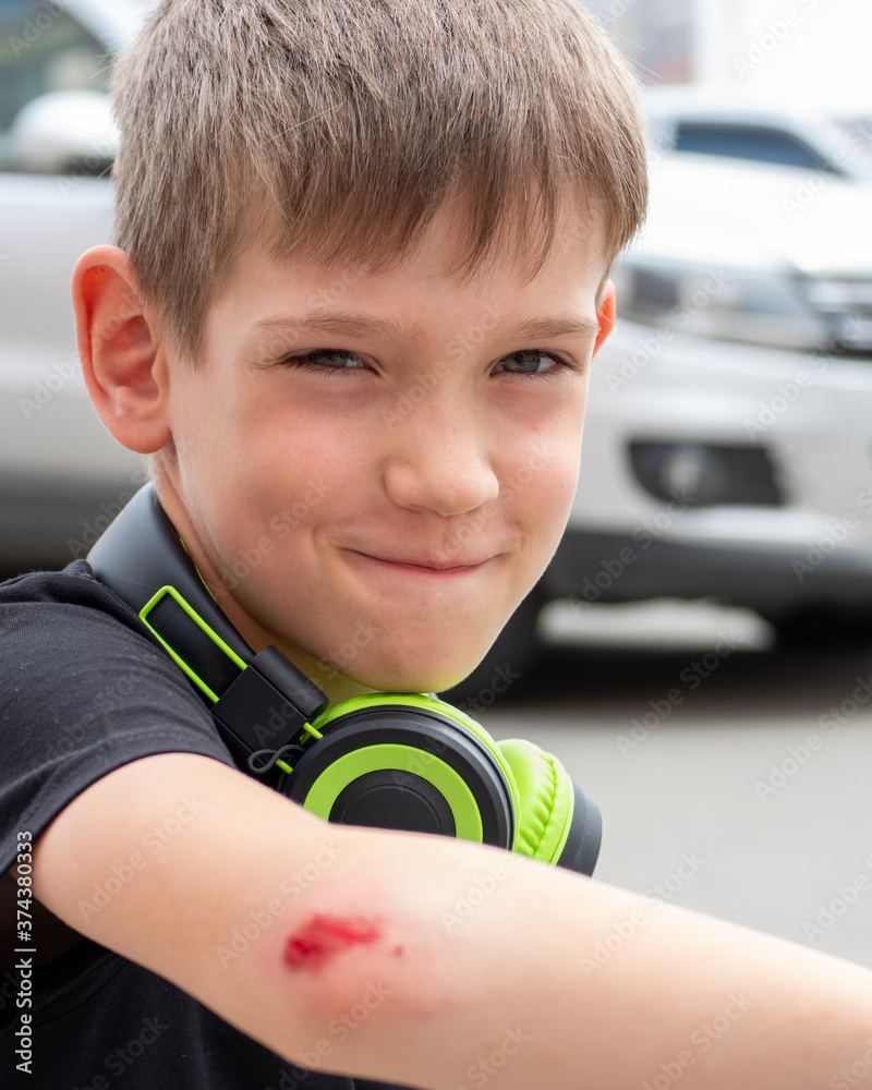 Selective focus Boy with a fresh wound on his arm, blood on his elbow ...
