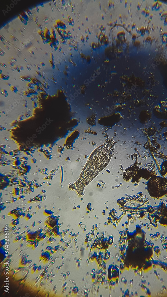 Foto de Mycetozoa slime mold and Purple sulfur bacteria PSB in dead ...