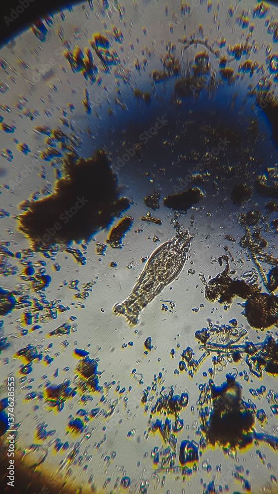 Foto de Mycetozoa slime mold and Purple sulfur bacteria PSB in dead ...