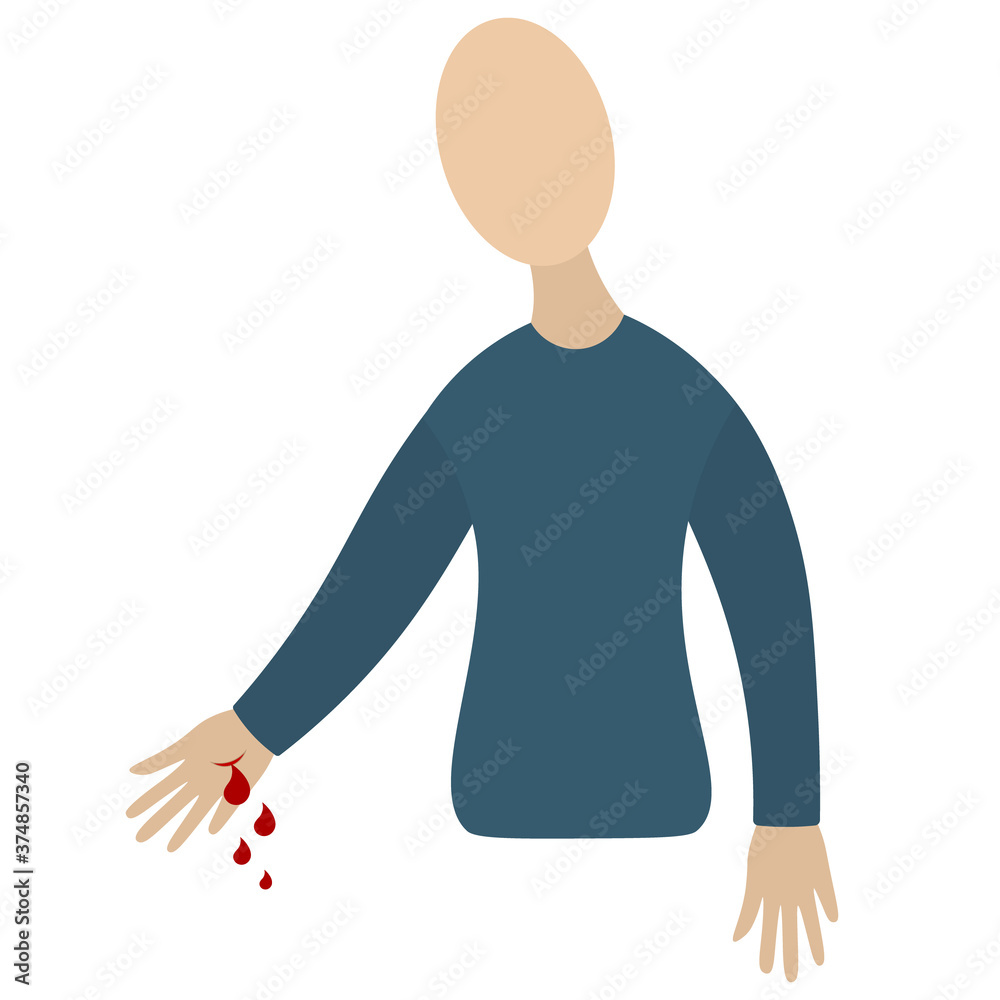 Damage to the skin of the hand, trauma, scratch, bleeding. Prevention ...