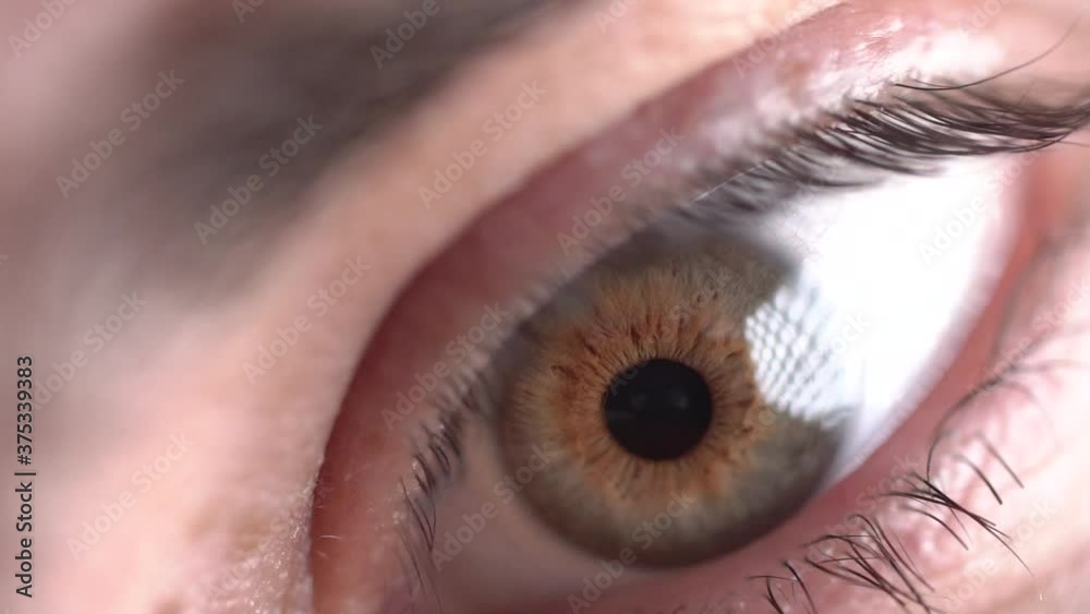 An eye operation to improve vision, effects on pupil dilation and ...