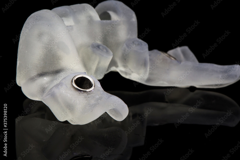 dental template with dental support for implantation stability, taken ...