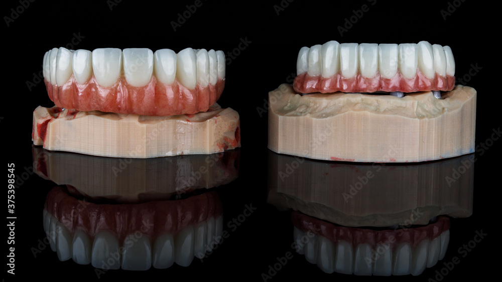 two dentures of the upper and lower jaw on models, filmed on black ...