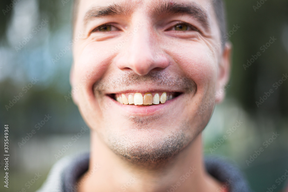 Yellow damaged tooth of a smiling Caucasian man in close-up. Focus on ...