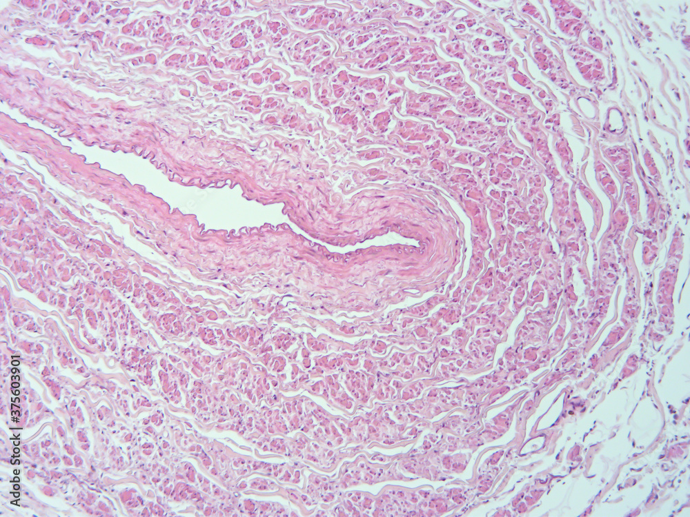 picture of histology human tissue with microscope from laboratory (not ...