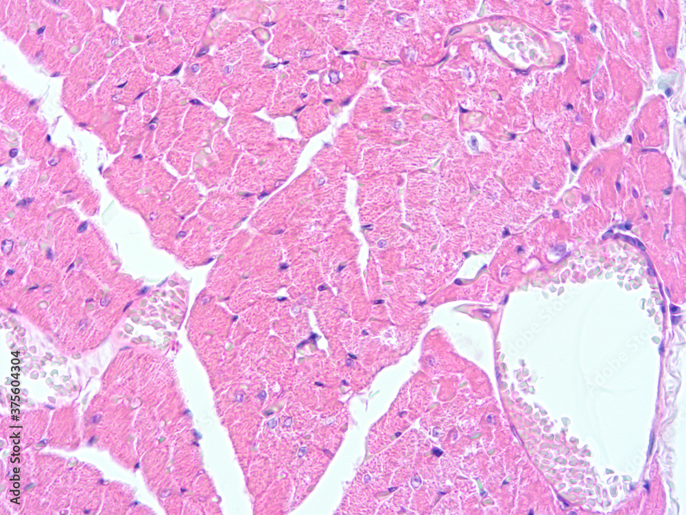 picture of histology human tissue with microscope from laboratory (not ...