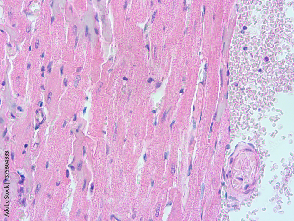 picture of histology human tissue with microscope from laboratory (not ...