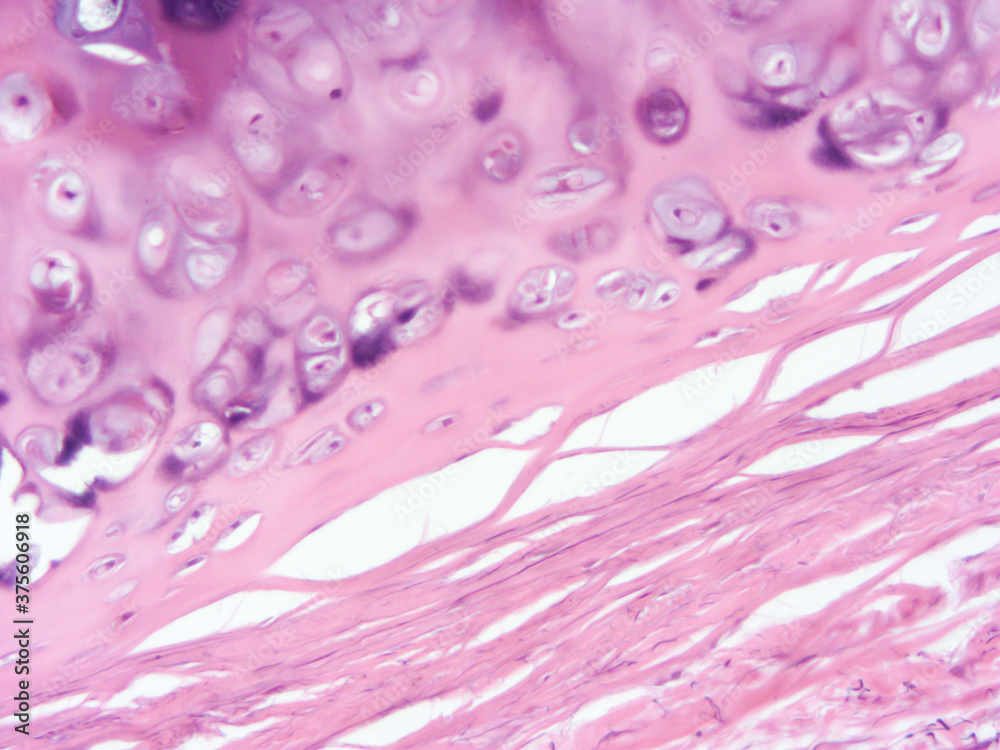 picture of histology human tissue with microscope from laboratory (not ...