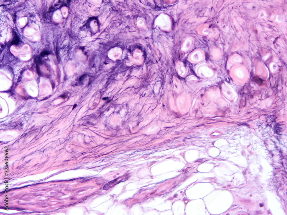 picture of histology human tissue with microscope from laboratory (not ...