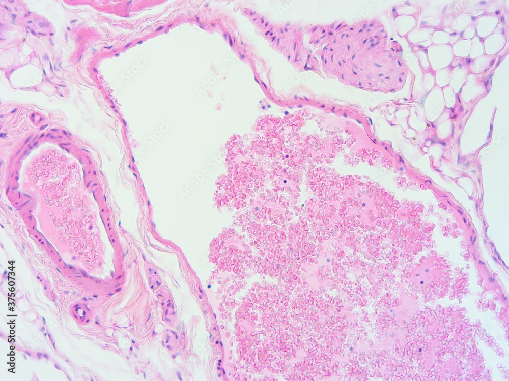 picture of histology human tissue with microscope from laboratory (not ...