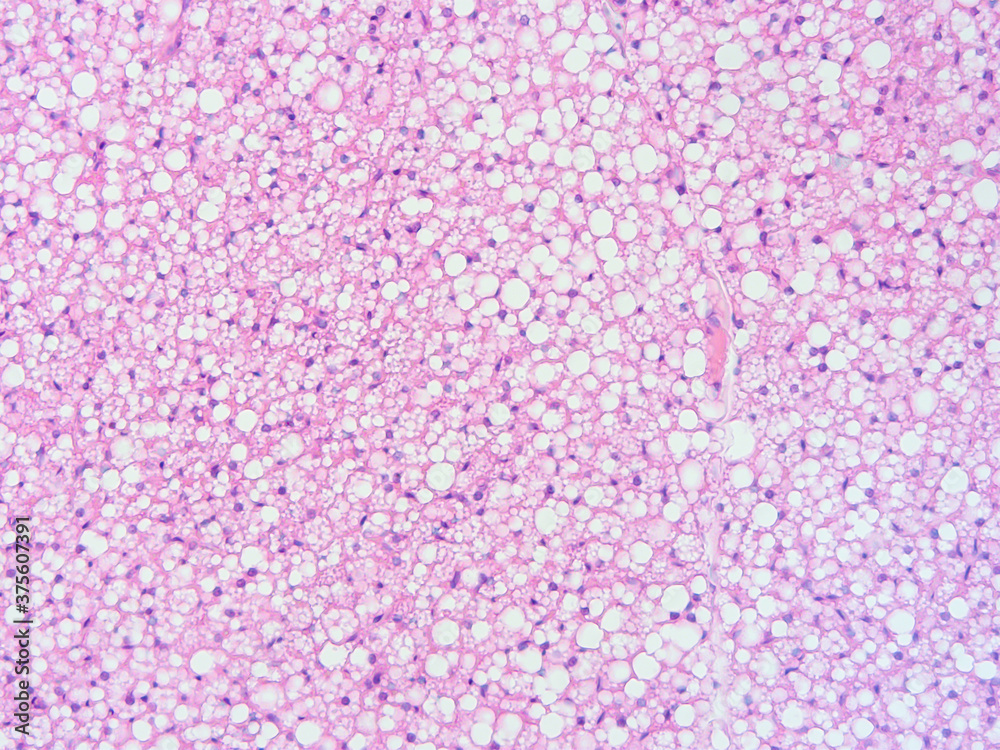 picture of histology human tissue with microscope from laboratory (not ...