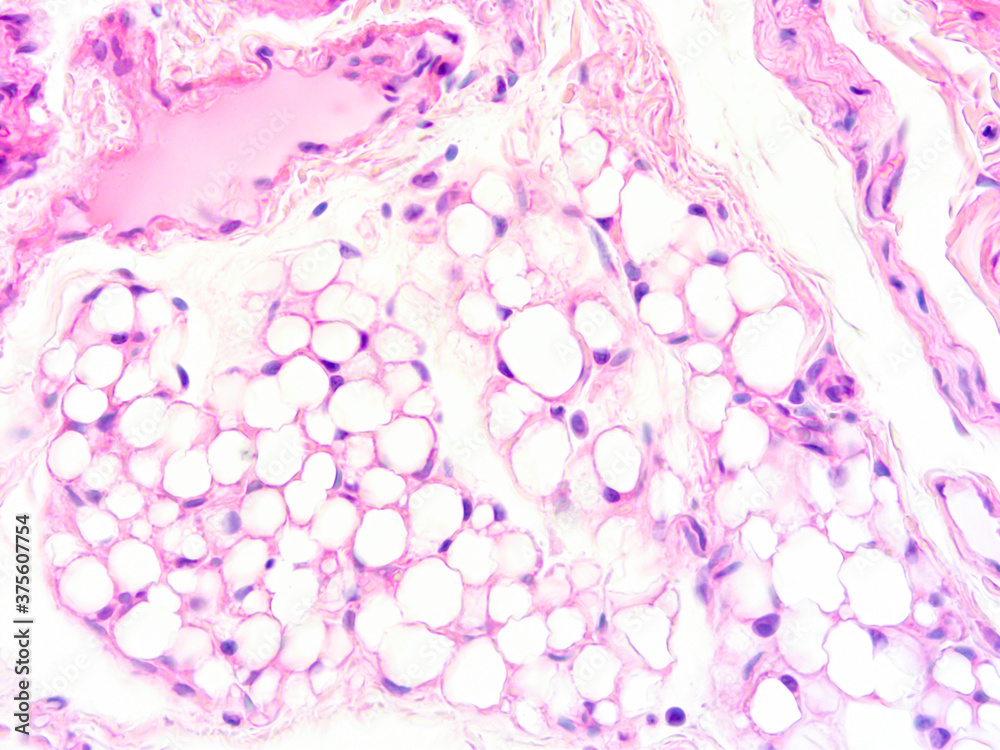 picture of histology human tissue with microscope from laboratory (not ...