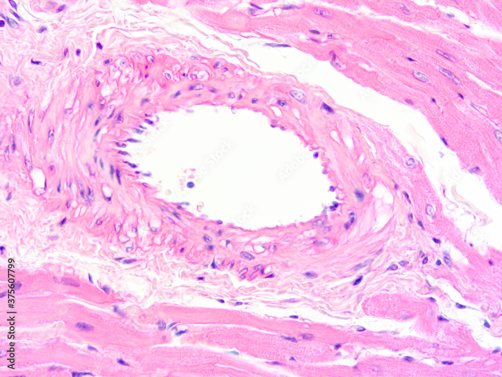picture of histology human tissue with microscope from laboratory (not ...