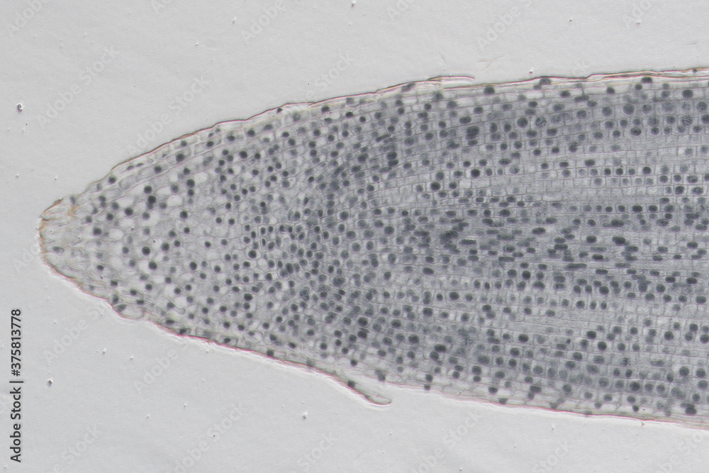 Typical plant cell of root tip, micrograph Stock Photo | Adobe Stock