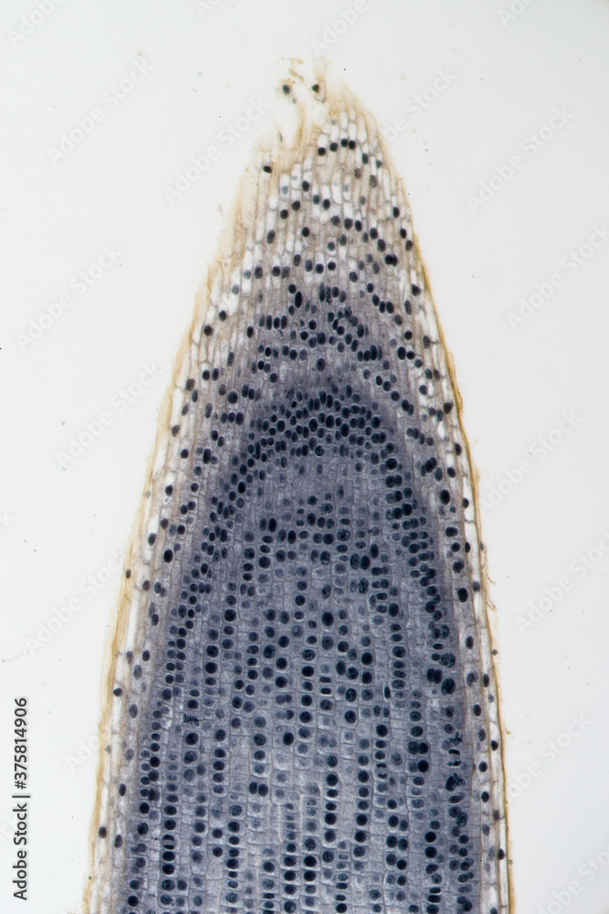 Typical plant cell of root tip, micrograph Stock Photo | Adobe Stock