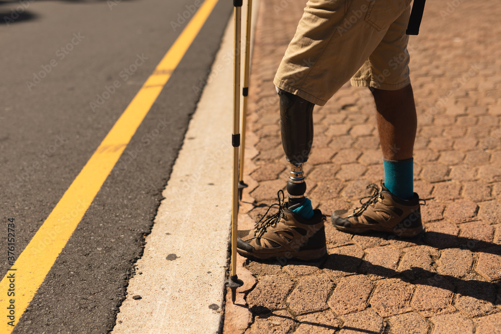 Black African American Male athlete with prosthetic leg Stock Photo ...