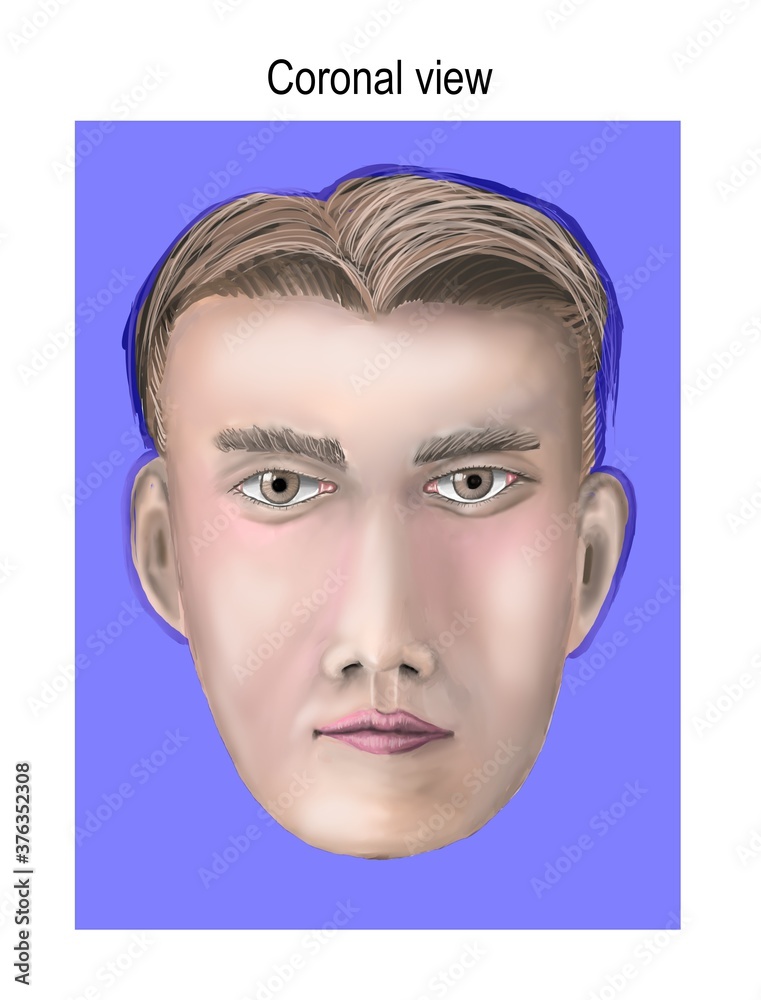 the difference slides of brain imaging regarding to CT and MRI images ...