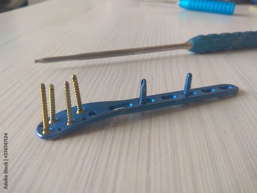 Surgical plates in traumatology for treatment bone fracture Stock Photo ...