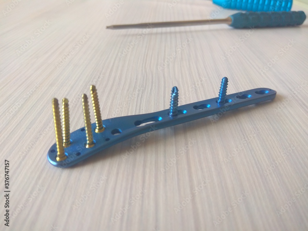 Surgical plates in traumatology for treatment bone fracture Stock Photo ...