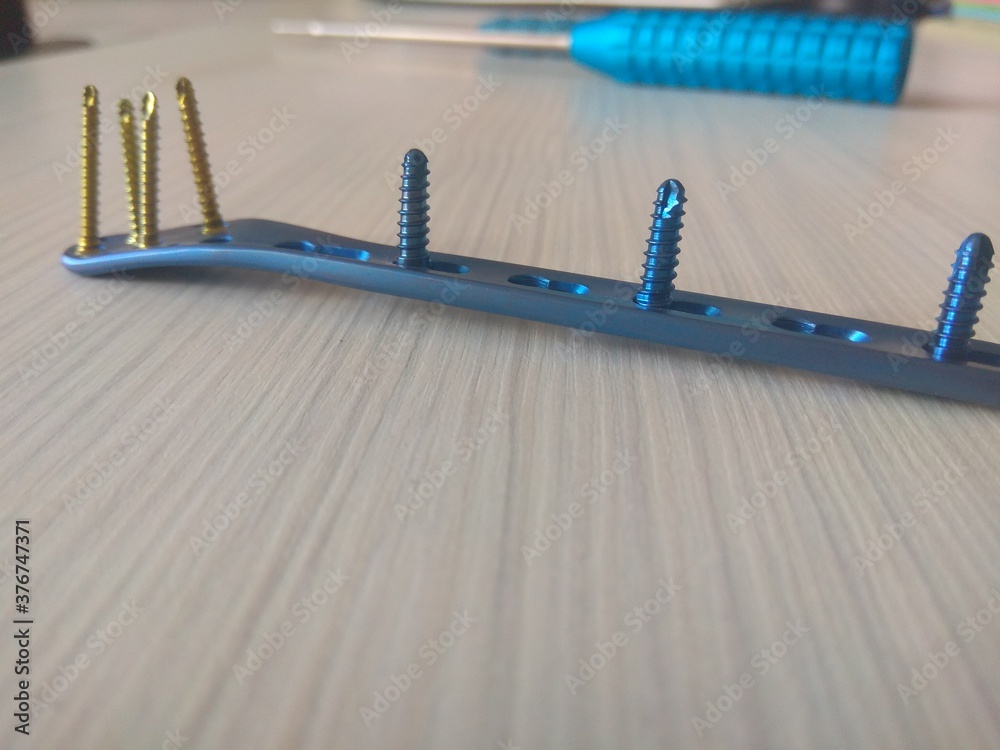 Surgical plates in traumatology for treatment bone fracture Stock Photo ...