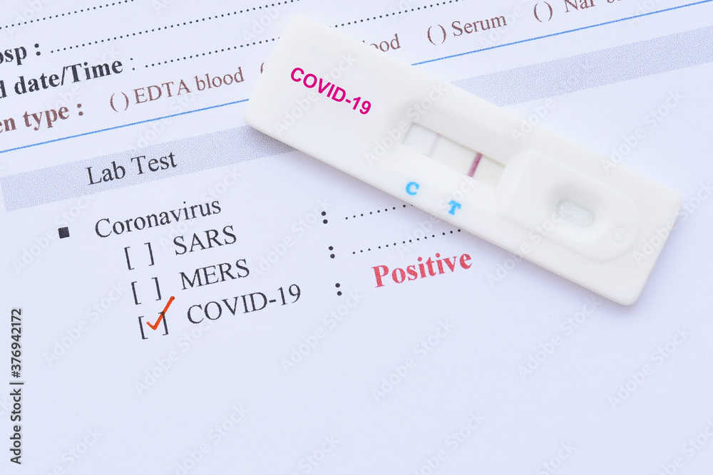 Positive test result by using rapid test device for COVID-19 virus ...