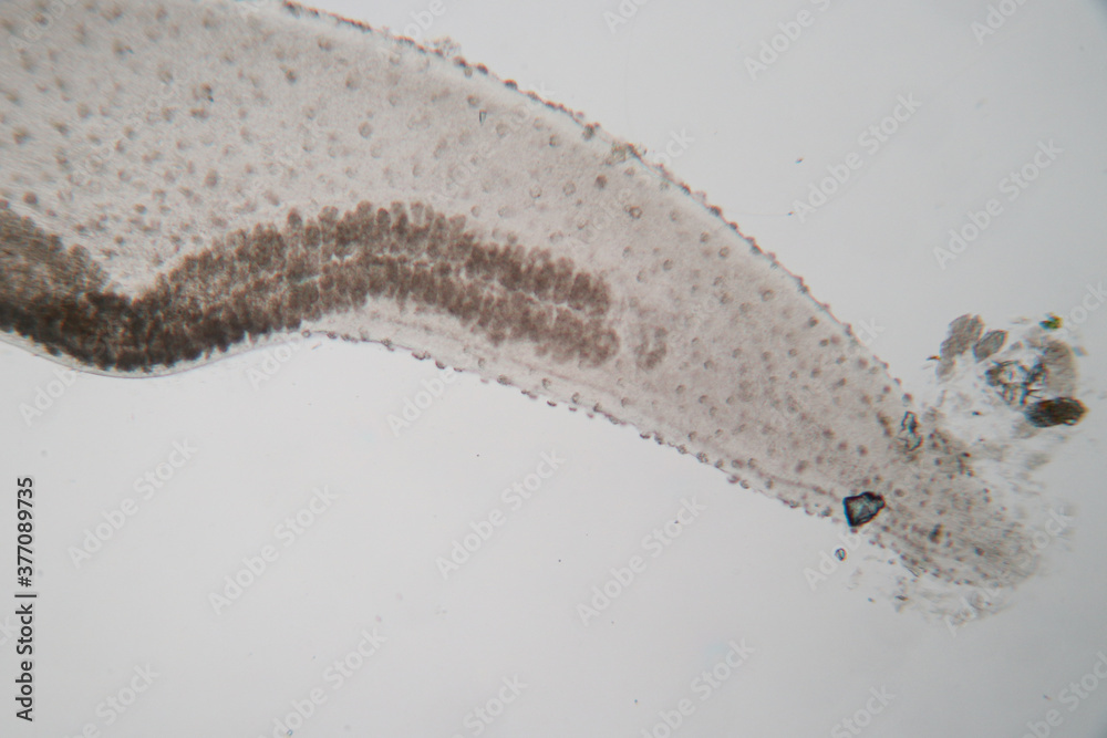 The study parasite or worms is a freshwater fish parasite in laboratory ...