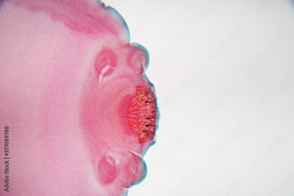 The study parasite or worms is a freshwater fish parasite in laboratory ...