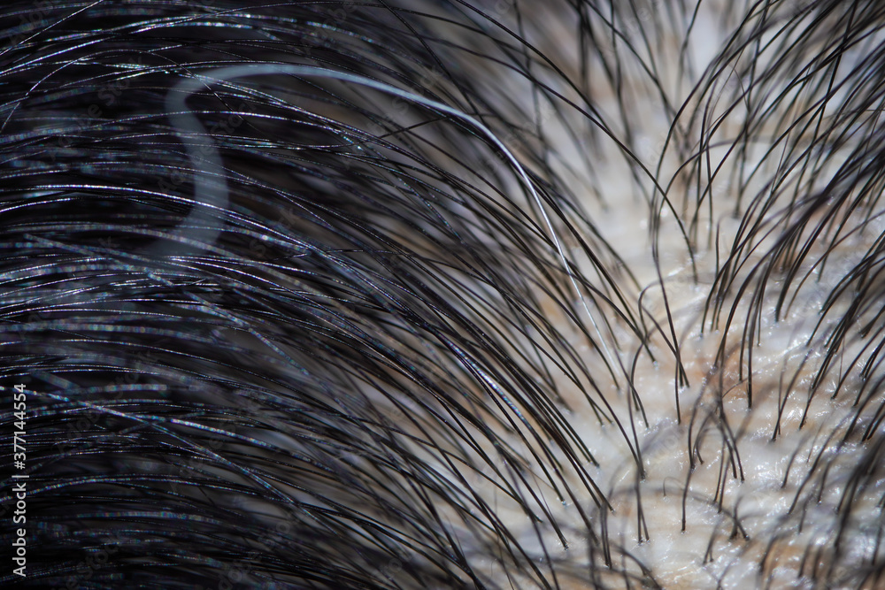 Macro photo of human scalp with a strand of white hair, close up photo ...