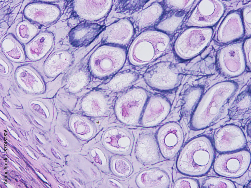 Histology of human tissue, show epithelial tissue and connective tissue ...