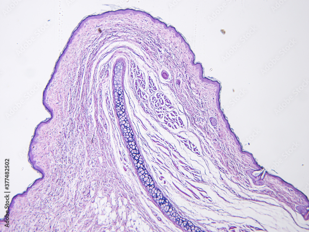 Histology of human tissue, show epithelial tissue and connective tissue ...