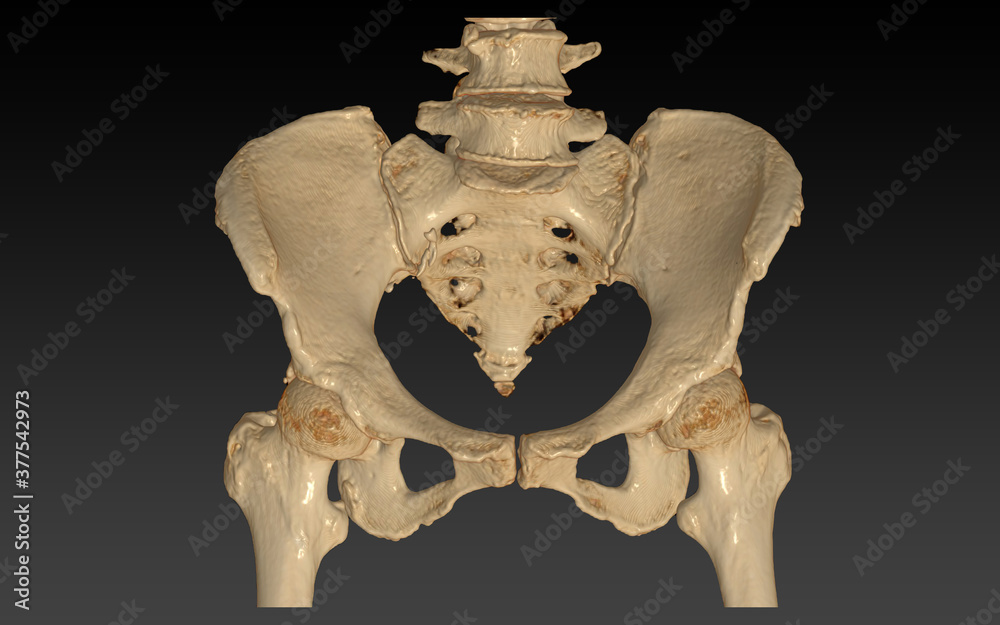 CT Scan of pelvic bone with both hip joint 3D rendering image isolated ...