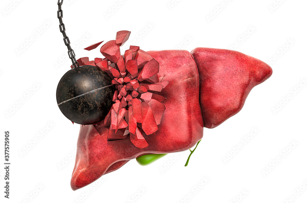 Human liver destroying by wrecking ball. Pain in liver, liver disease ...