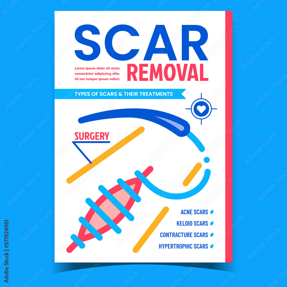Scar Removal Creative Advertising Banner Vector. Acne And Keloid ...