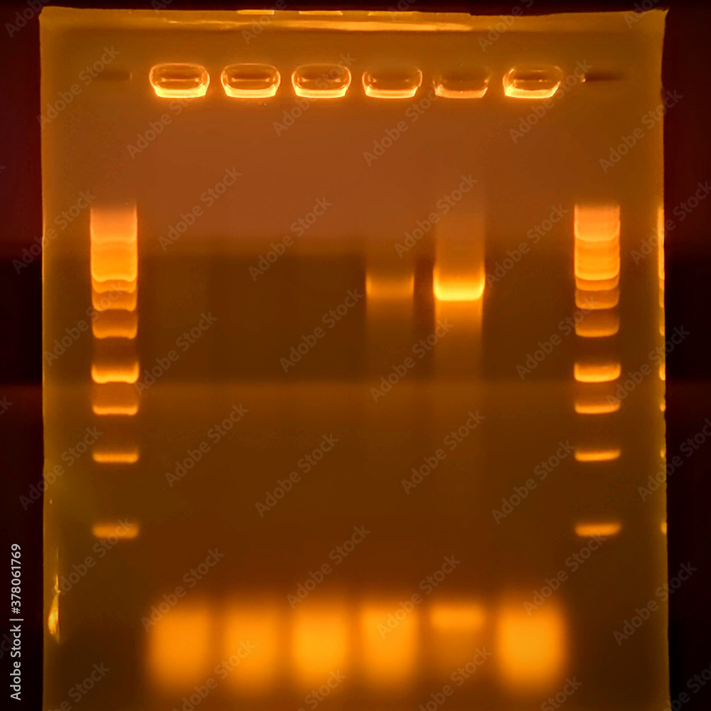 Poster result of agarose gel electrophoresis of PCR products – Wall Art ...