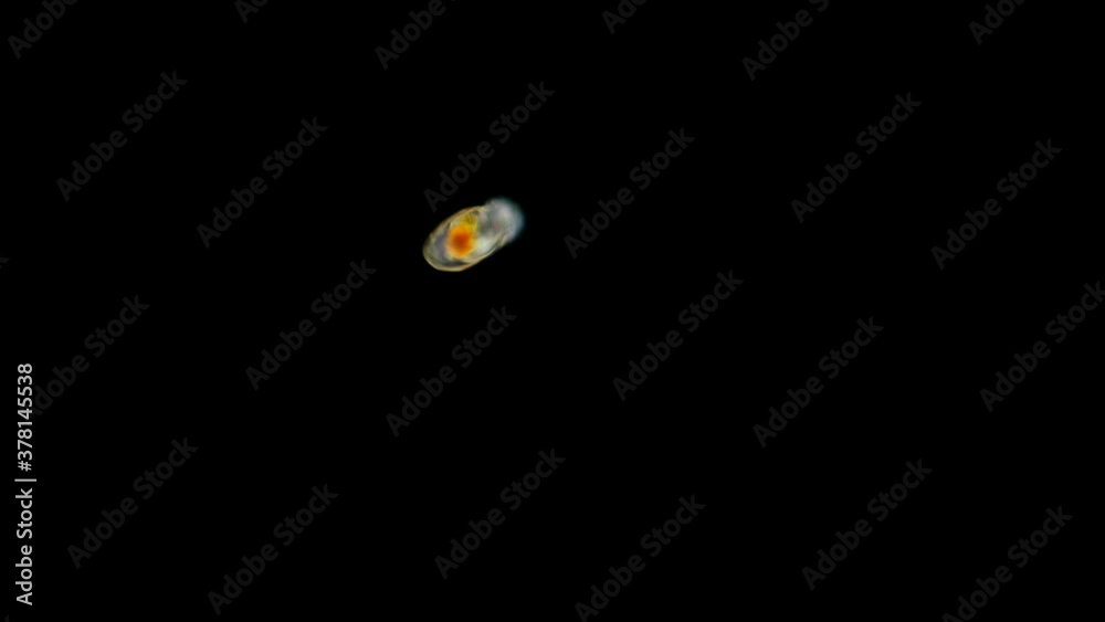 young rotifer Keratella sp. under a microscope, of the Brachionidae ...