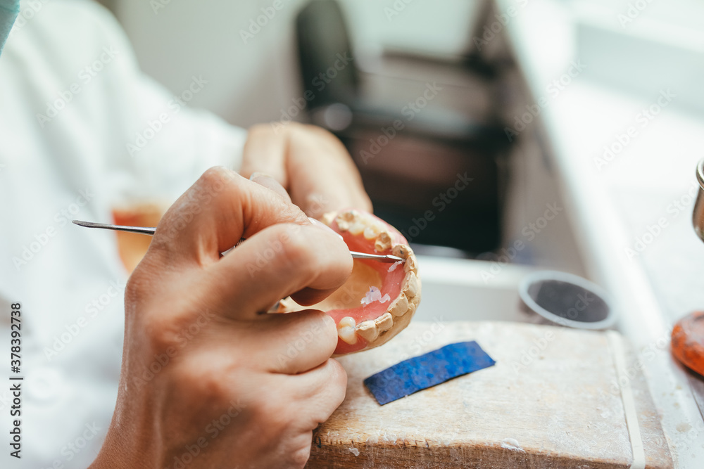 Dental technician making a flexible prosthesis in your laboratory Stock ...