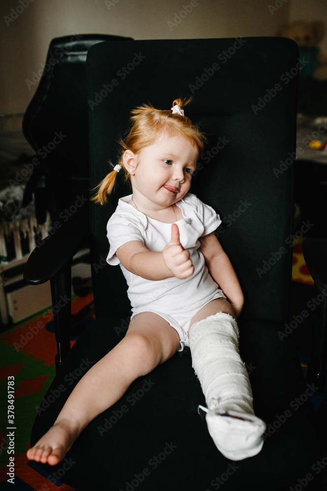 Child with bandage on leg heel fracture. Broken left foot, bone, calf ...