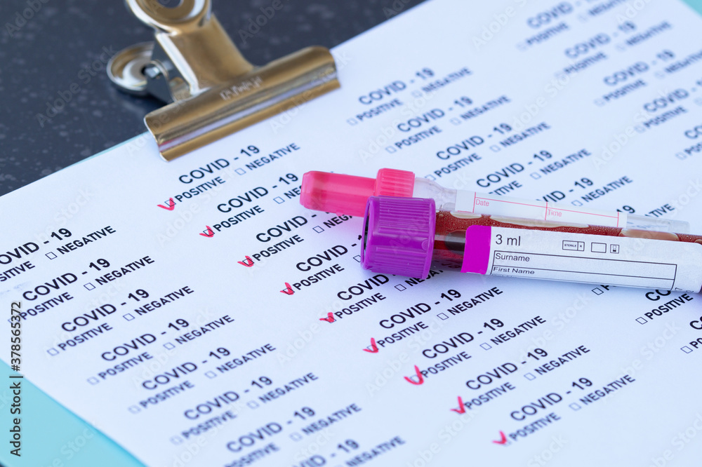 Disease detection report of Covid-19 and test tube with real Blood ...