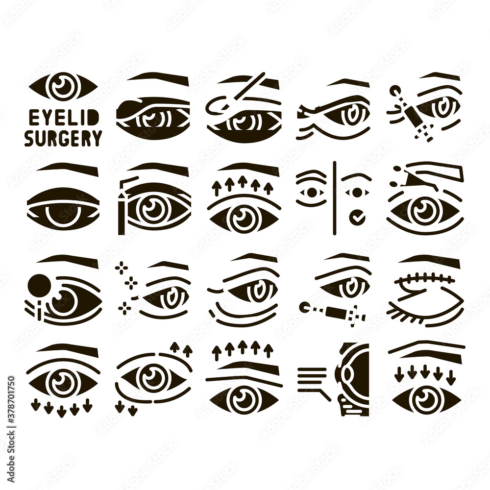 Eyelid Surgery Healthy Glyph Set Vector. Eyelid Surgery Blepharoplasty ...
