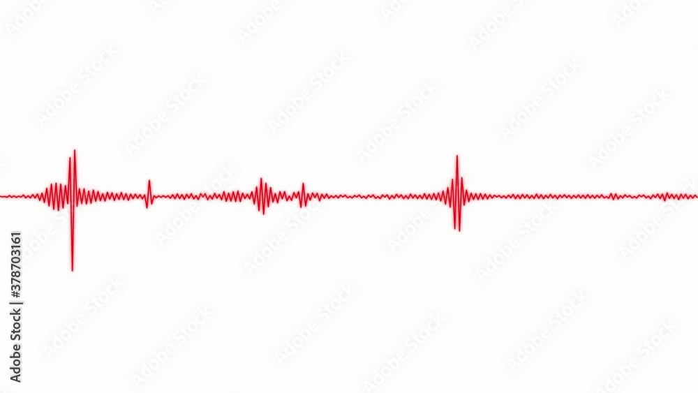 Electrocardiogram is a medical examination to see the electrical ...