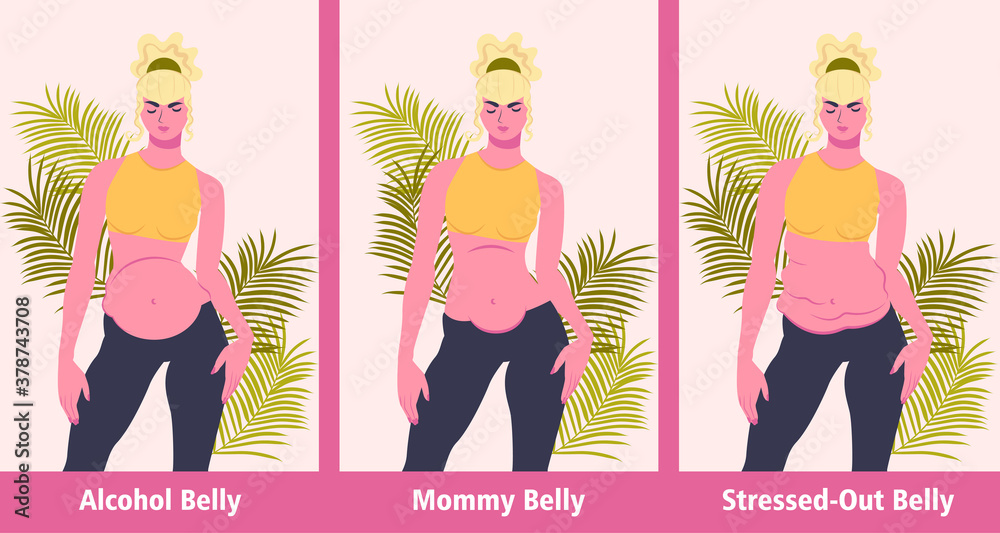 Three common female tummy types: alcohol, mommy and stressed-out ...