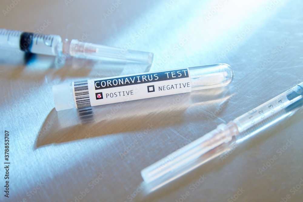 Positive coronavirus covid-19 test swab in vial surrounded by two ...
