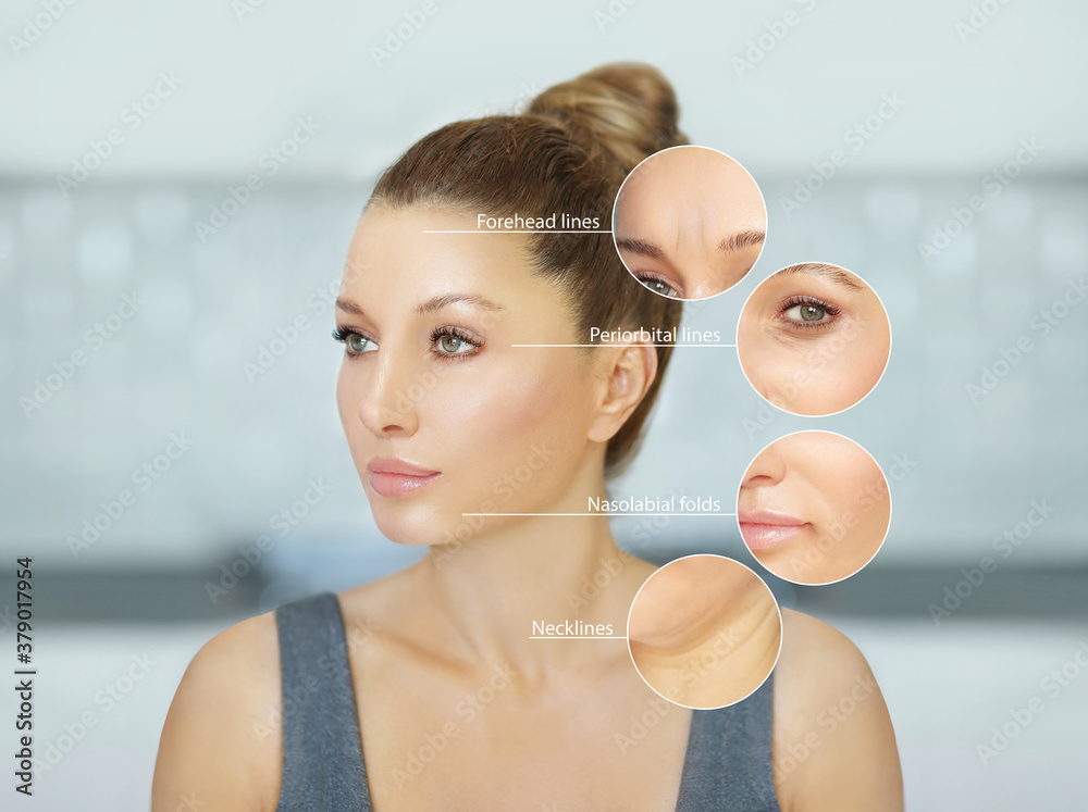 Effects of ageing,Frown/scowl lines ,Nasolabial folds,Neck ,Under eye ...