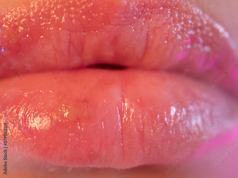 Beautiful female lips cracked from frost, wind, lack of vitamins ...