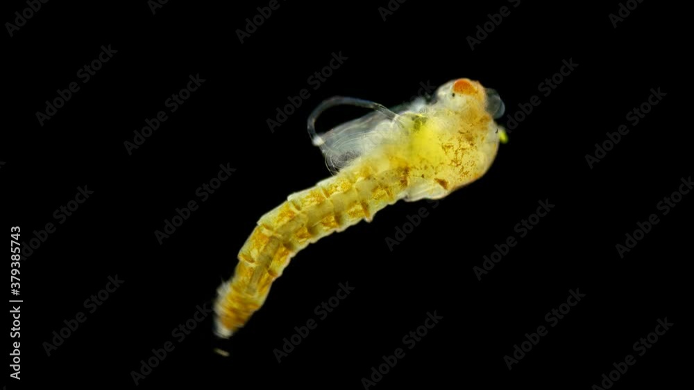 Pupa (larva) of a mosquito under a microscope, order Diptera, an adult ...