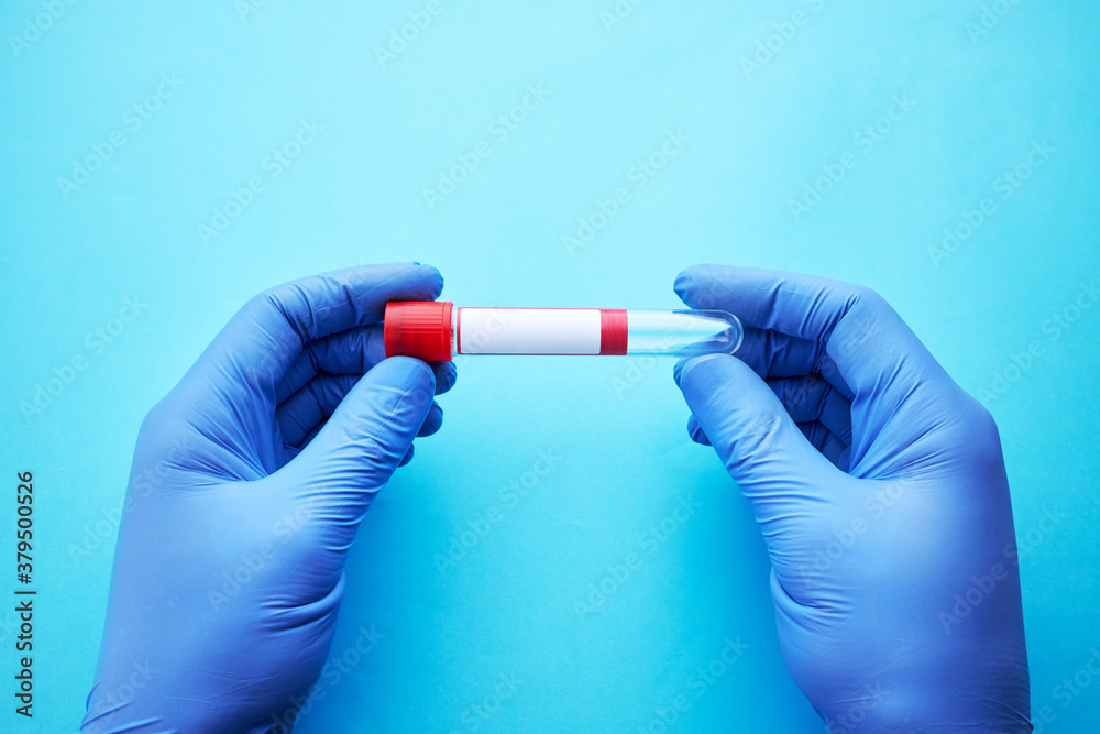 person holding empty blank blood collection tube. medical research and ...